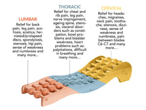 Non-Specific Back Pain Causes and Treatment