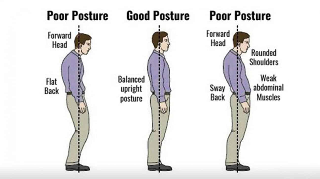 Poor Posture Archives Spinal Backrack Poor Posture Archives Spinal Backrack
