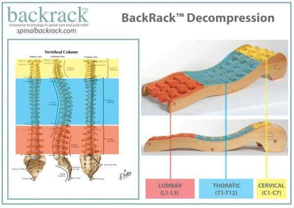 cervical bulging disc Archives - Spinal Backrack