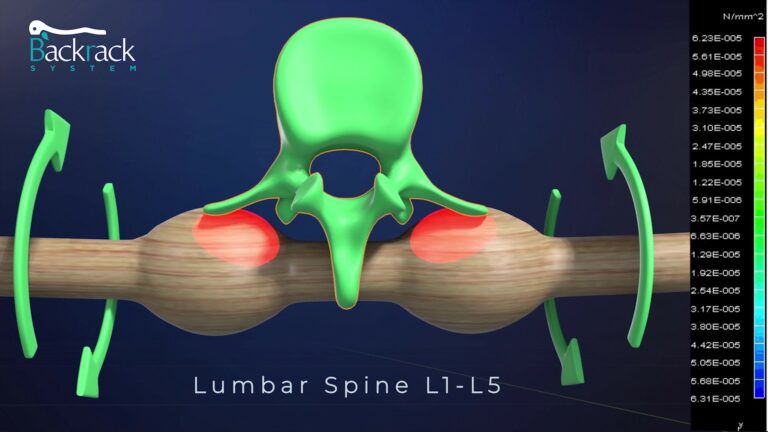 L5 S1 Disc Pain Treatment Options