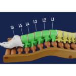 Backrack™ – Spinal Decompression Device - Spinal Backrack