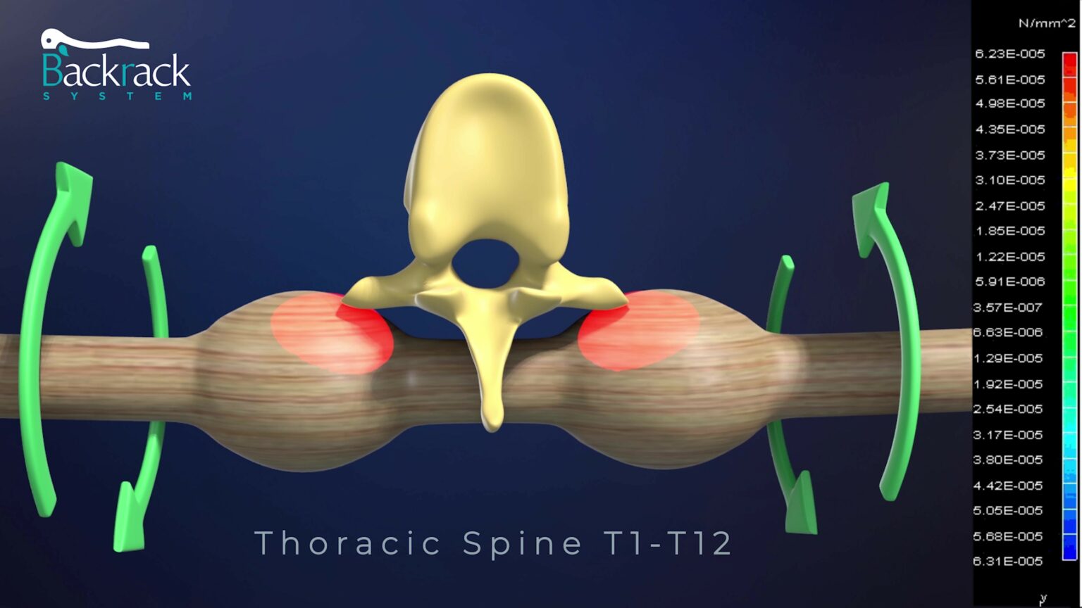What causes thoracic back pain? - Spinal Backrack