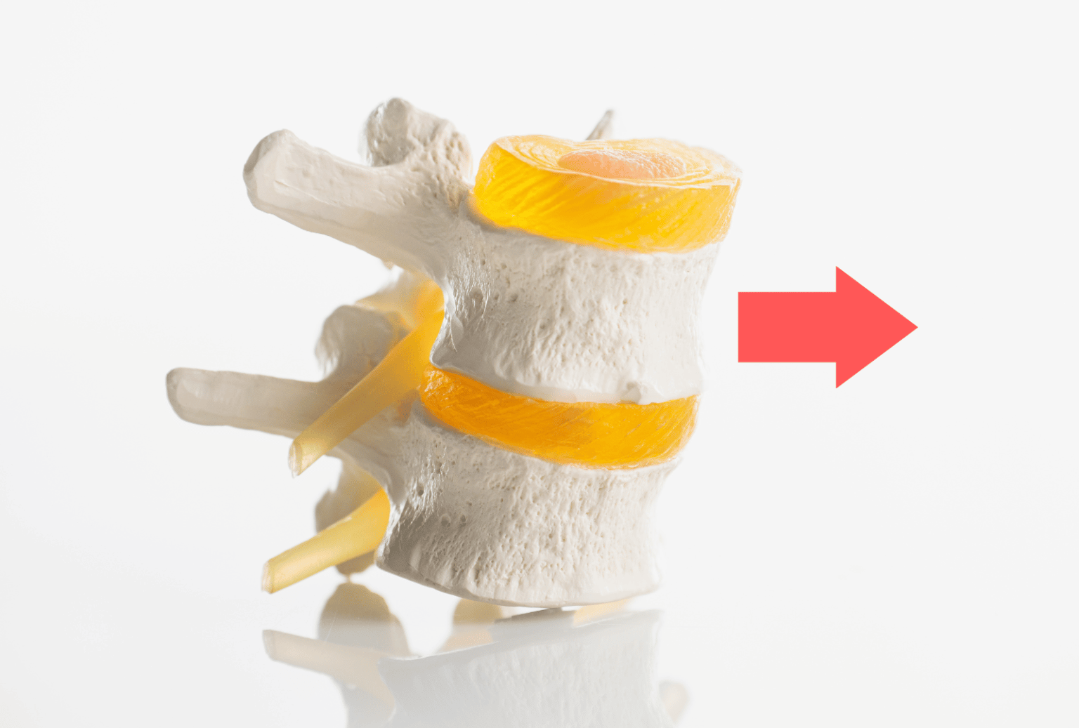 An Easy Treatment for Spinal Misalignment - Spinal Backrack