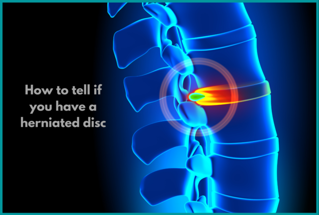 backrack exercise for herniated disc Archives - Spinal Backrack