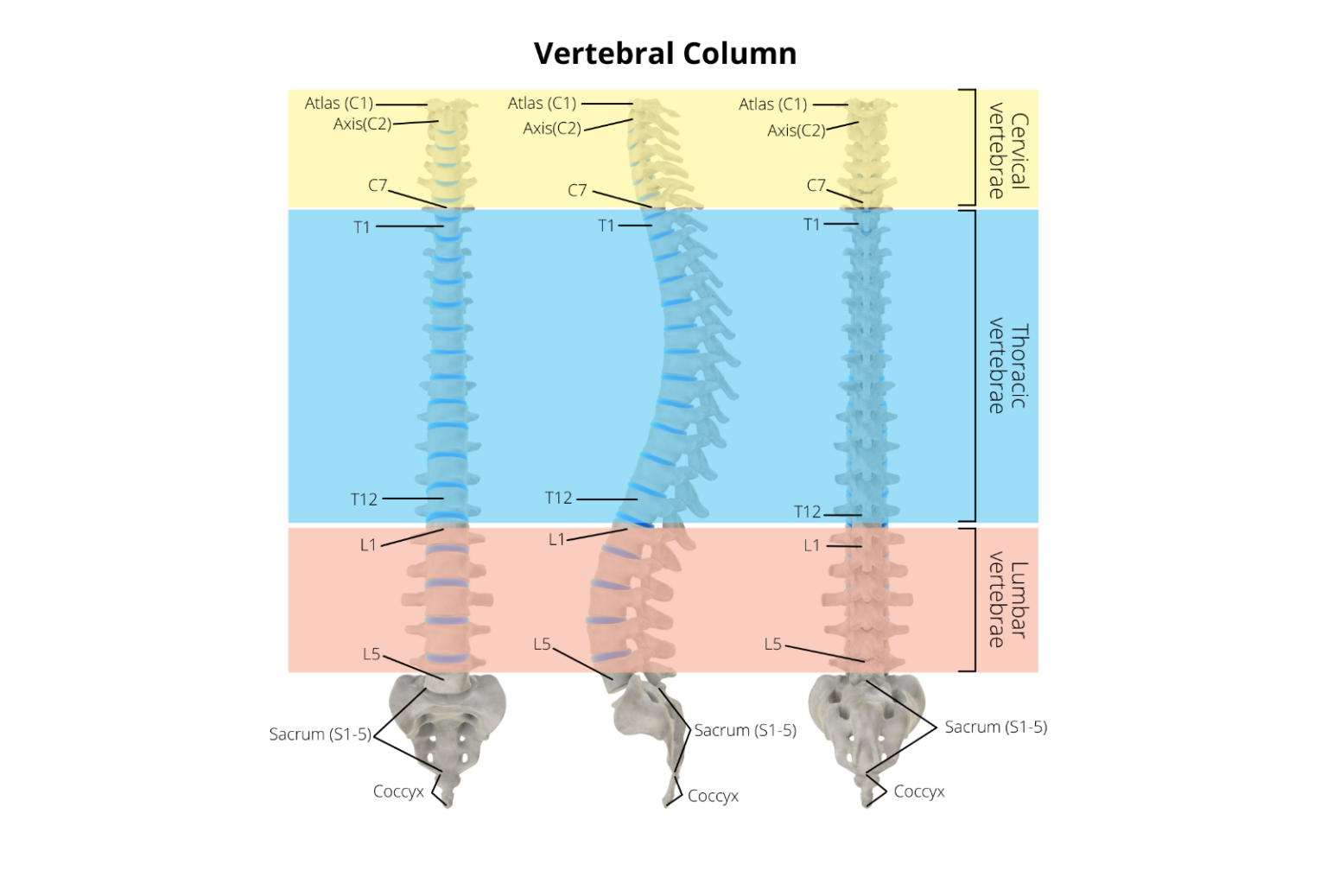 What is middle back pain? - Spinal Backrack