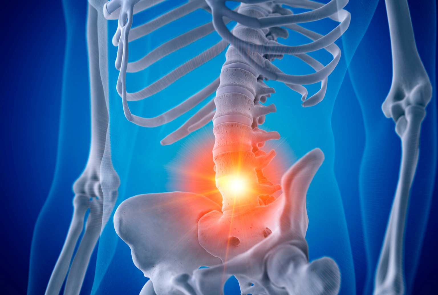 Diagnosing Ankylosing Spondylitis