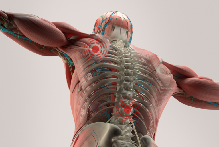 Musculoskeletal pain in the Lower Back - Treatment Options