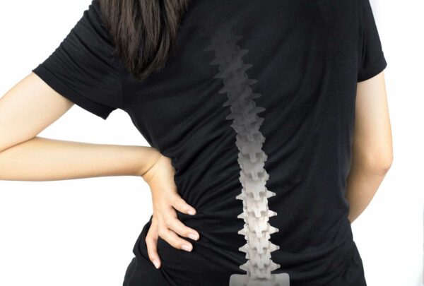 Facet joint syndrome Archives - Spinal Backrack