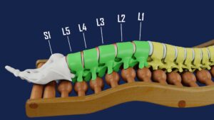 When Your Lower Back Vertebrae Are Out Of Alignment - Spinal Backrack