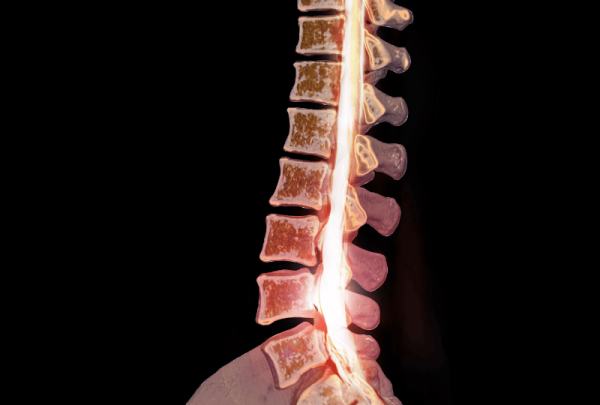 herniated disc treatment options Archives - Spinal Backrack
